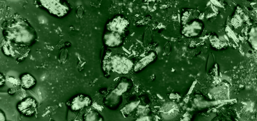Prebiotics 101: What Do They Actually Do?