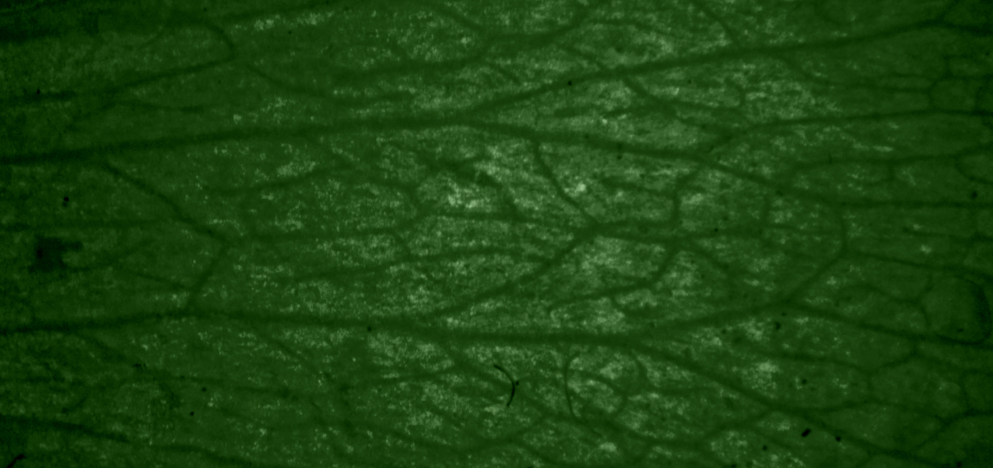 Lacticaseibacillus casei: What Science Says About This Gut Microbe